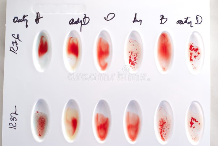 Blood type test stock image. Image of label, grouping - 19398513