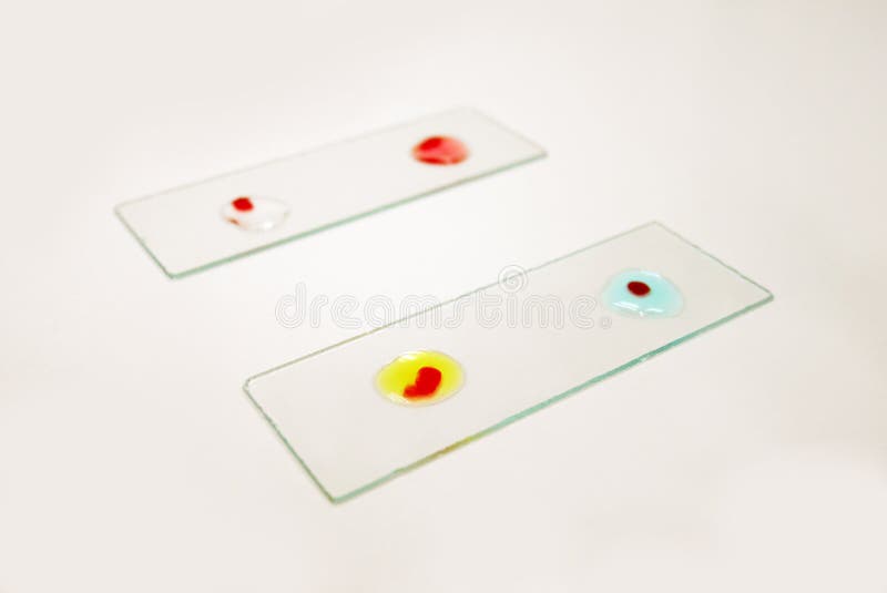 Blood type testing stock photo. Image of test, plates - 92957618