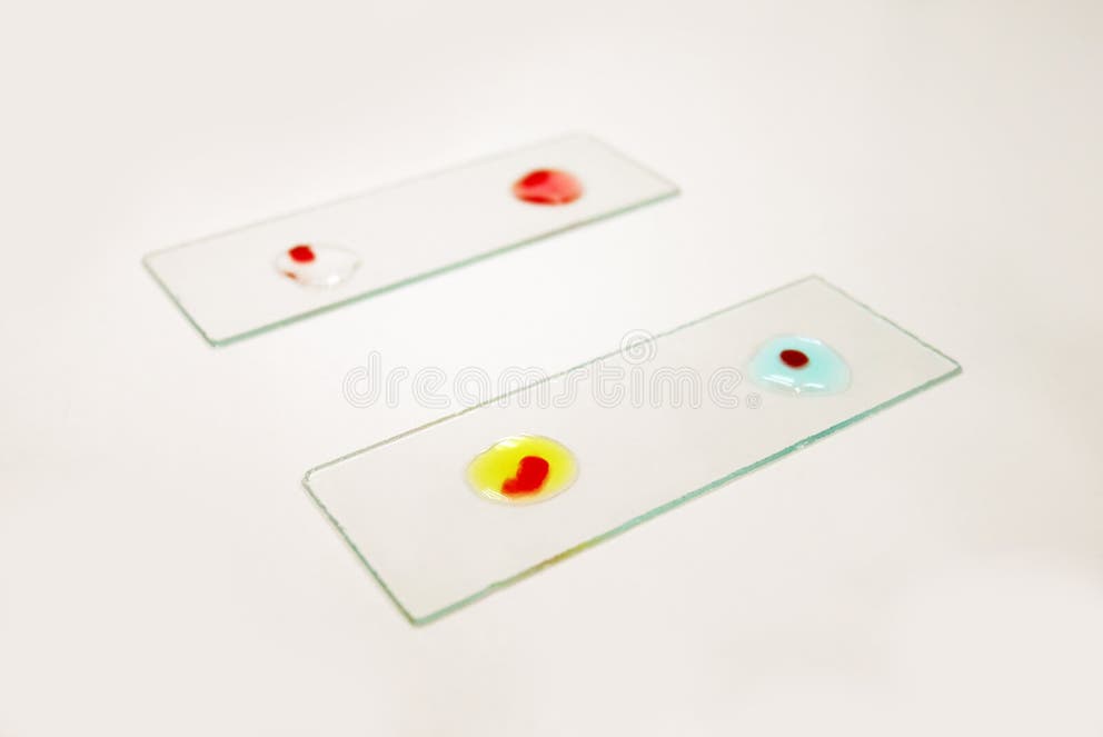 Blood type testing stock photo. Image of test, plates - 92957618