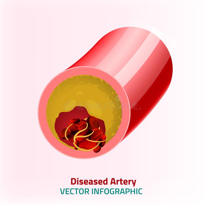 Bloodstream Circulatory Stock Illustrations – 729 Bloodstream ...