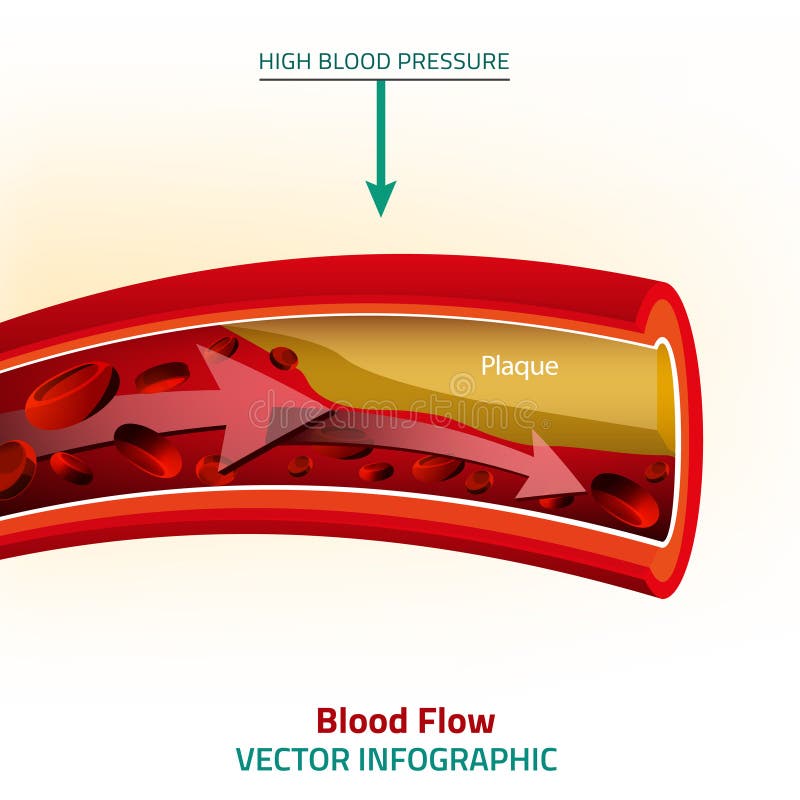 Bloodstream Circulatory Stock Illustrations – 729 Bloodstream ...