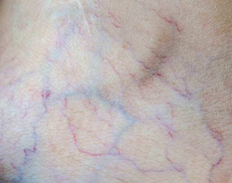 Blood veins of a human stock image. Image of skin, person - 185712577