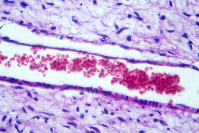 Blood Vessel with Red Blood Cells, Light Micrograph Stock Image - Image ...