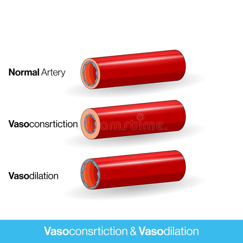 Vasoconstriction, Clot Formation in Blood Vessel Stock Illustration ...