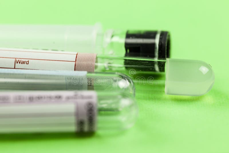 Blood vials stock image. Image of test, diagnostic, tube - 41594629