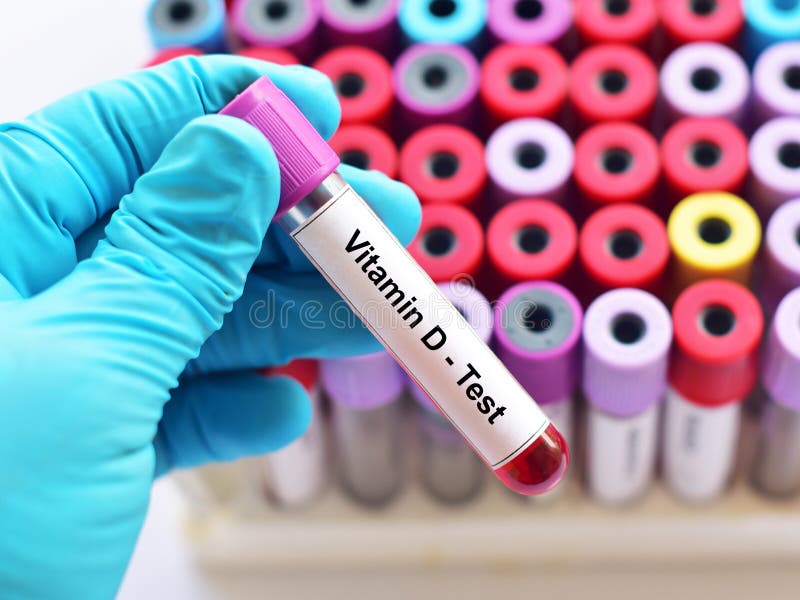 Blood for vitamin D test stock photo. Image of medical - 286453864