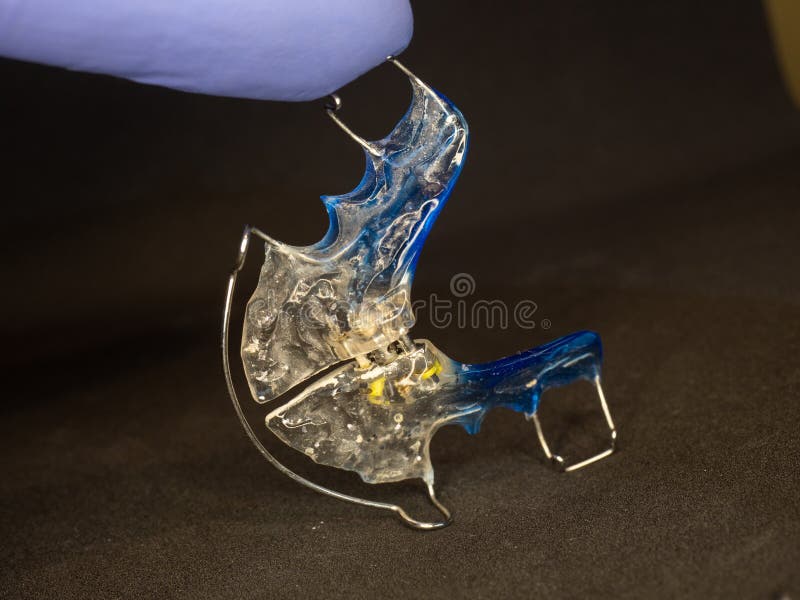 Dental Retainer stock photo. Image of yellow, piece, metal - 14267644