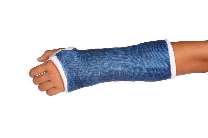 Broken Hand stock image. Image of recovery, orthopaedic - 21049313