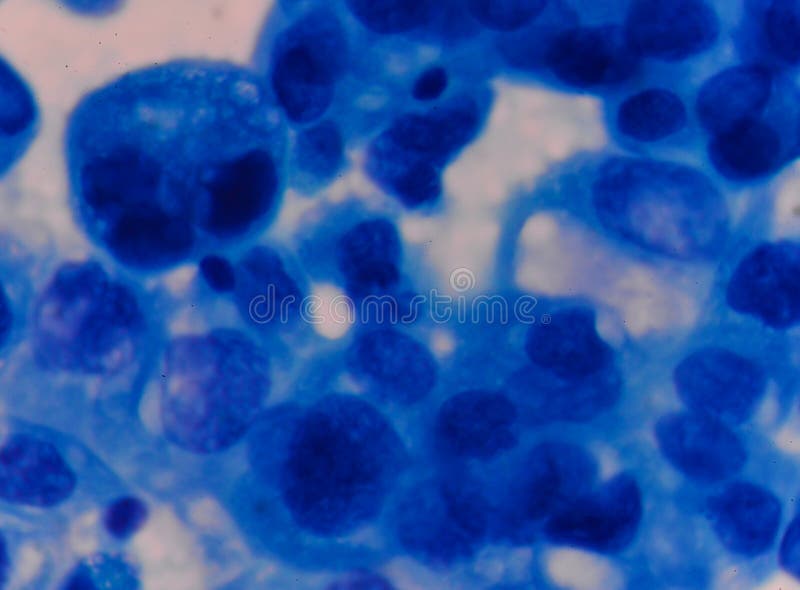 Blue cell with blue stain. stock photo. Image of cells - 96652914