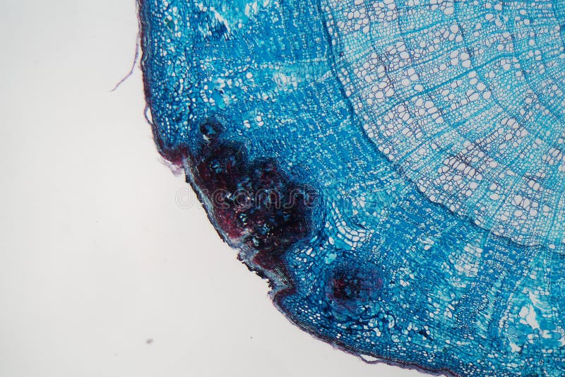 Cells of a Plant Stem with a Disease Under a Microscope Stock Image ...