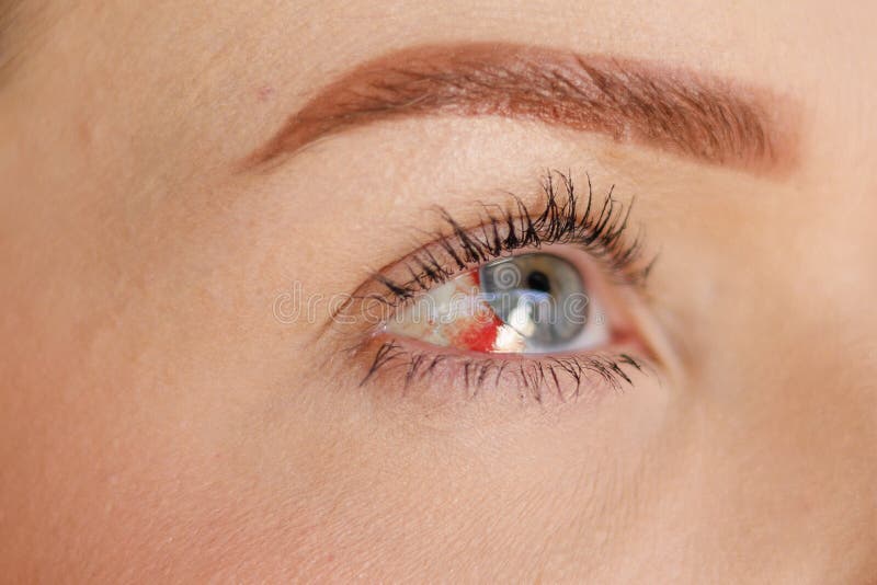Blue Eye on the Right Side of a Woman Stock Image - Image of medicine ...