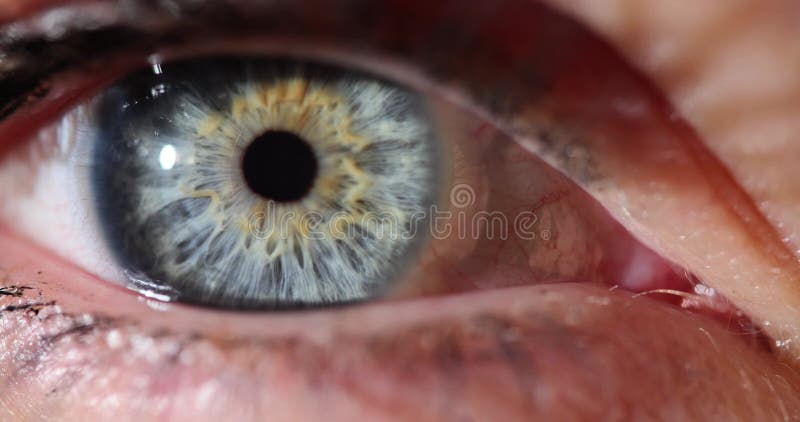 Doctor Model of Anatomy of Hip Joint of Pelvic Bone in Clinic Stock ...