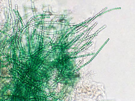 Blue Green Algae Under Microscopic View, Cyanobacteria Stock Image ...