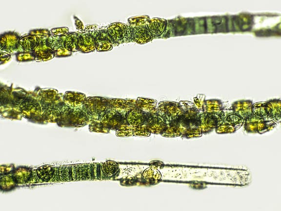 Blue Green Filamentous Algae Under Microscopic View, Cyanobacteria ...