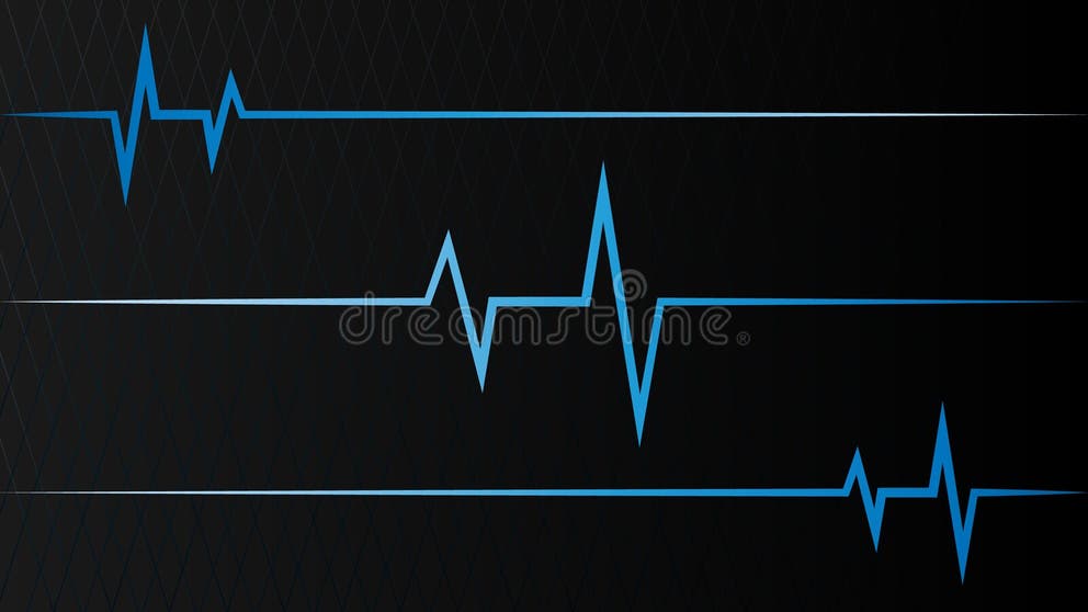 Striking Blue Heartbeat Trace Stock Illustrations – 1 Striking Blue ...