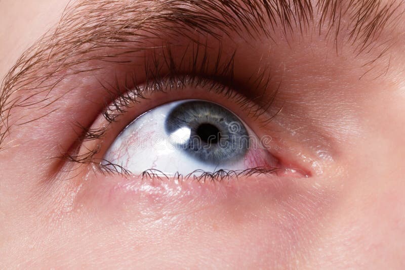 Blue Men Eye with Red Blood Vessels Stock Image - Image of blood, macro ...