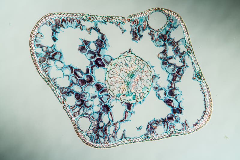 Spruce Needle Cross Section Stock Photos - Free & Royalty-Free Stock ...