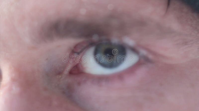 Frostbite Stock Footage & Videos - 924 Stock Videos