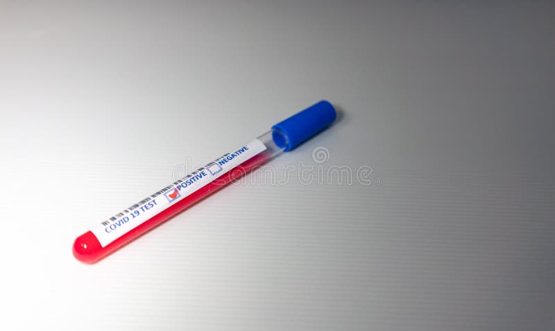 Blurry Image of a Sample Blood in Test Tube of Coronavirus Covid-19 ...