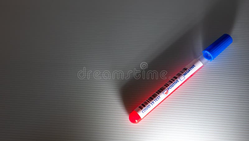 Blurry Image of a Sample Blood in Test Tube of Coronavirus Covid-19 ...