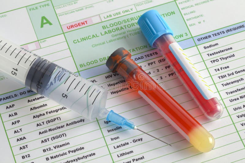 Blut-Arbeit stockbild. Bild von hämatologie, abgabe, medizin - 69003553