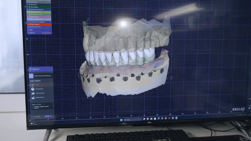 3D Denture Model Design Using Computer Software Stock Video - Video of ...