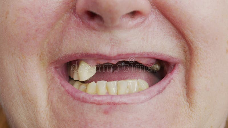 Boca Sem Dentes Fechada De Uma Mulher. Video Estoque - Vídeo de preto ...