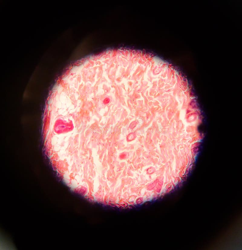 Cells of Human Find with Microscope. Stock Image - Image of ...