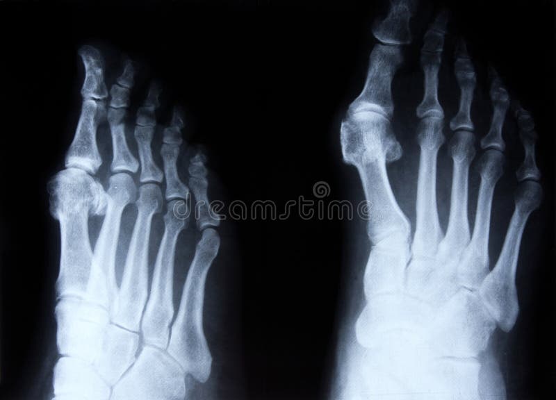 Body Legs Picture. Image: 6933572