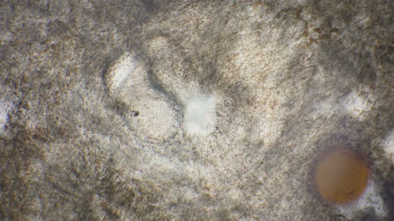 Leech Worm Stock Footage & Videos - 99 Stock Videos