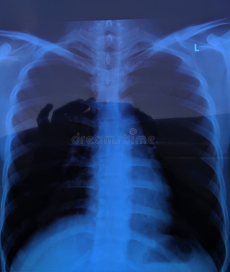 Body organ check stock photo. Image of dokter, check - 249354182