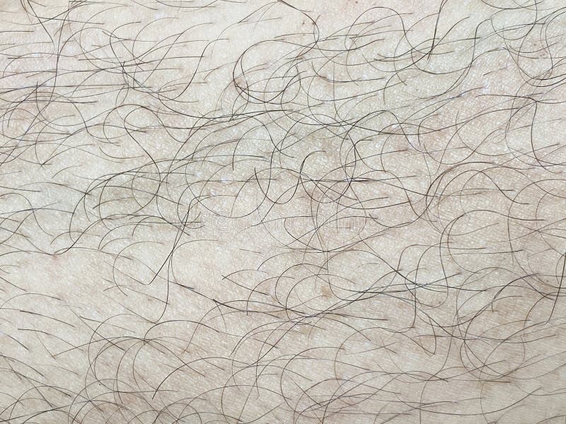 Body skin texture stock image. Image of injury, closeup - 266251851