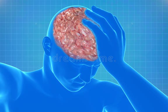 Body with visible headache stock illustration. Illustration of anatomy ...