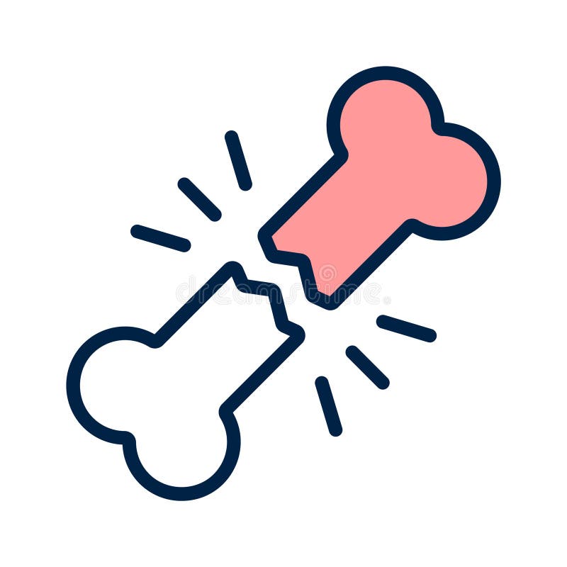 Bone Fracture stock vector. Illustration of outline - 332680760