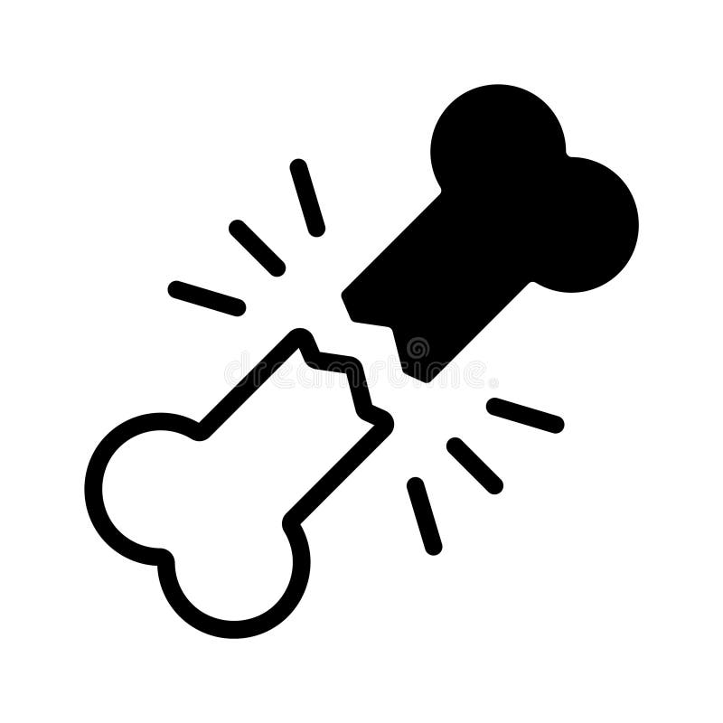 Bone Fracture stock vector. Illustration of healthcare - 332693105