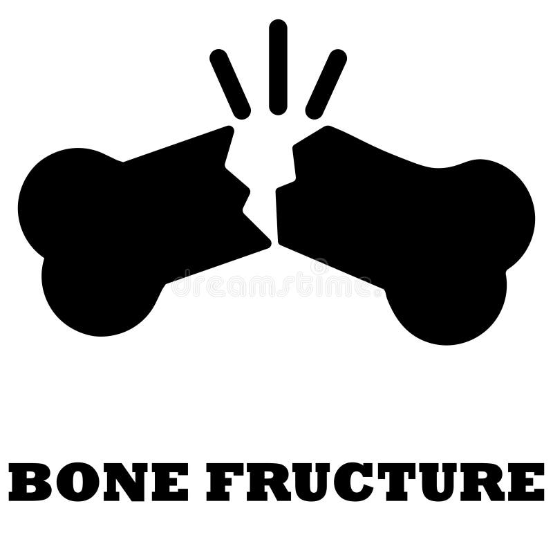Bone fracture icon design stock vector. Illustration of injury - 214732980