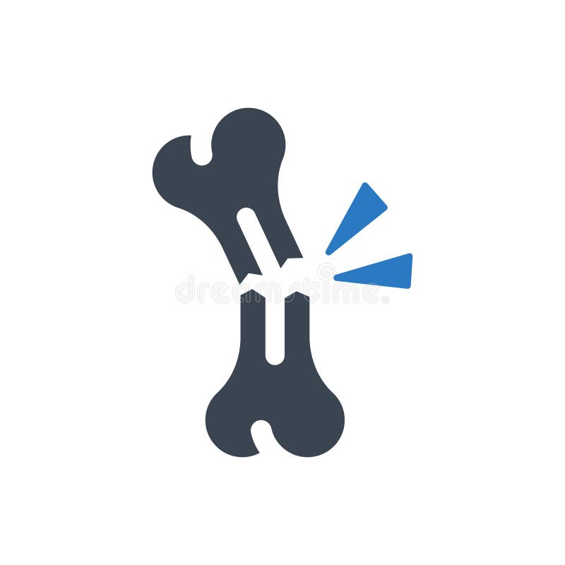 Bone fracture icon stock vector. Illustration of sign - 254772090