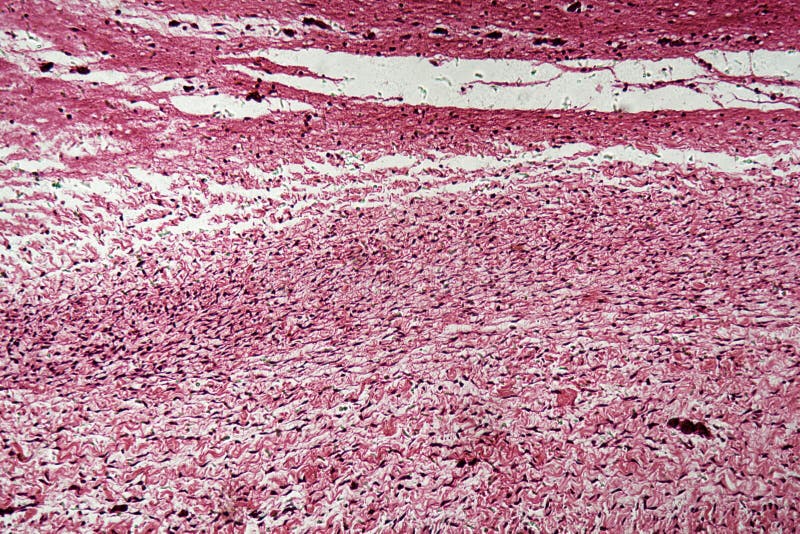 Human Fetal Head Under the Microscope Stock Photo - Image of foot ...