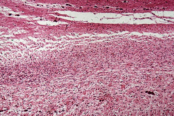 Human Fetal Head Under the Microscope Stock Photo - Image of foot ...