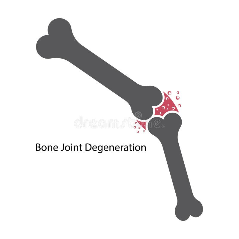 Bone Joint Degeneration Icon Stock Vector - Illustration of medicine ...