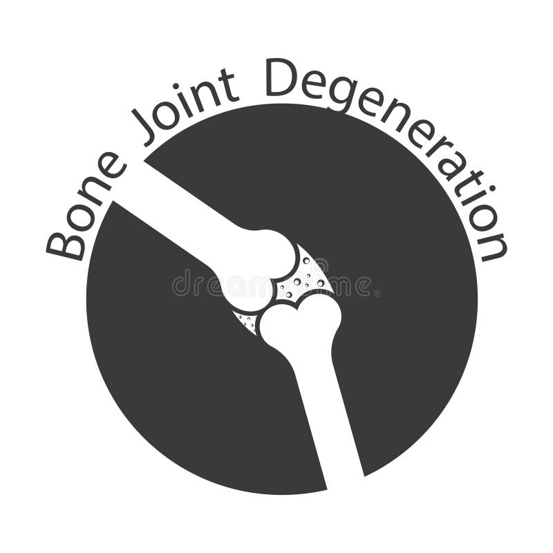 Bone Joint Degeneration Icon Stock Vector - Illustration of herniated ...