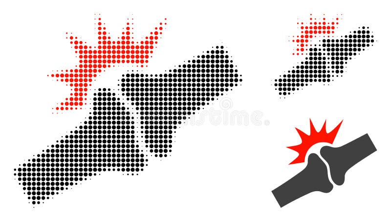 Bone Joint Fracture Halftone Dotted Icon Stock Illustration ...