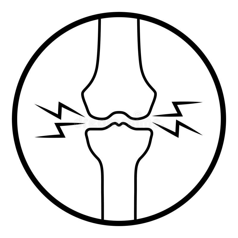 Arthritis and Joint Pain Infographic Stock Vector - Illustration of ...