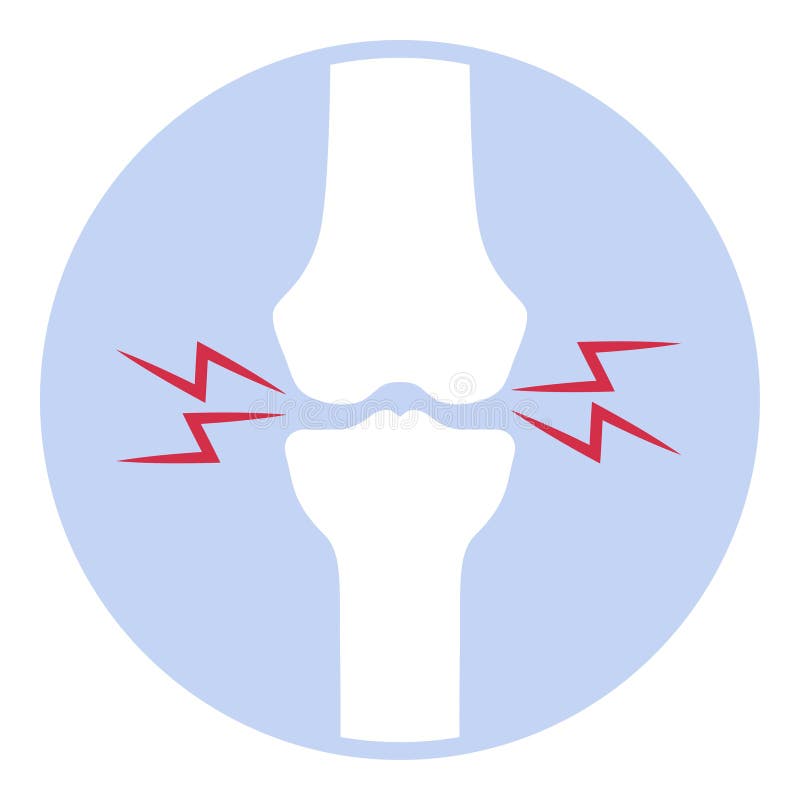 Arthritis and Joint Pain Infographic Stock Vector - Illustration of ...