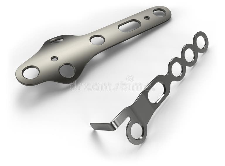 Bone plates stock illustration. Illustration of white - 49722947