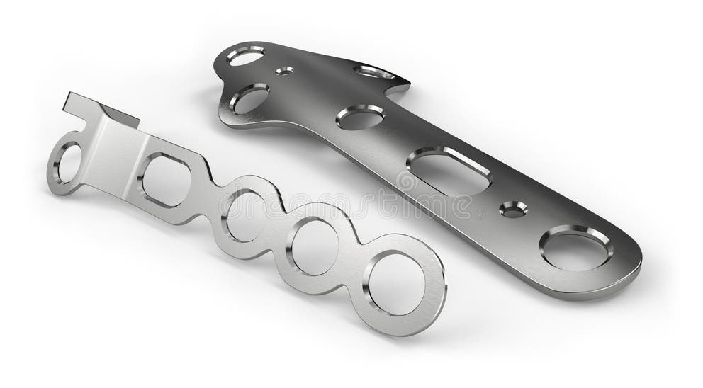 Bone plates stock illustration. Illustration of fixation - 49723215