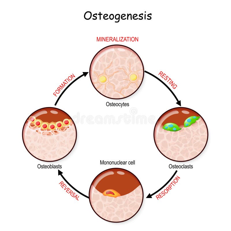 Bone Remodeling. Describe a Process of Ossification Stock Vector ...