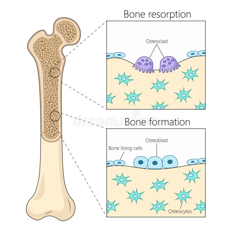 Bone Resorption Formation Diagram Medical Science Stock Illustration ...
