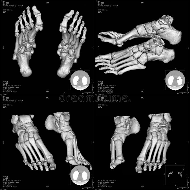 3D foot scanner stock image. Image of orthopaedics, scanner - 48448457
