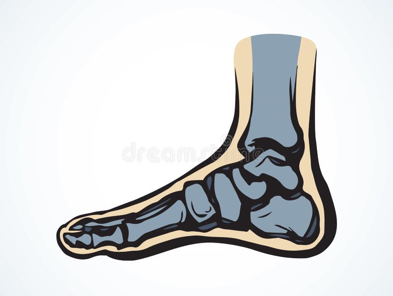 Bones of the Foot. Vector Drawing Stock Vector - Illustration of bone ...